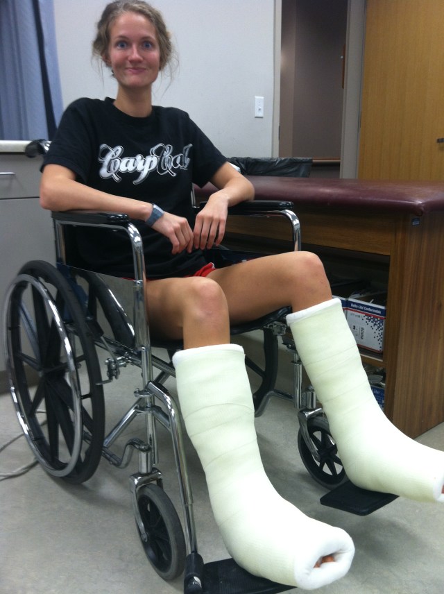 Claire’s Feet. The casts come off. | Ann's Words